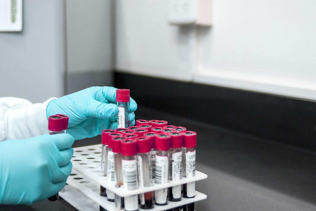 Medtimes HPV Home Test Kit with Report【Detect 43 types of HPV】 – 原測 ...